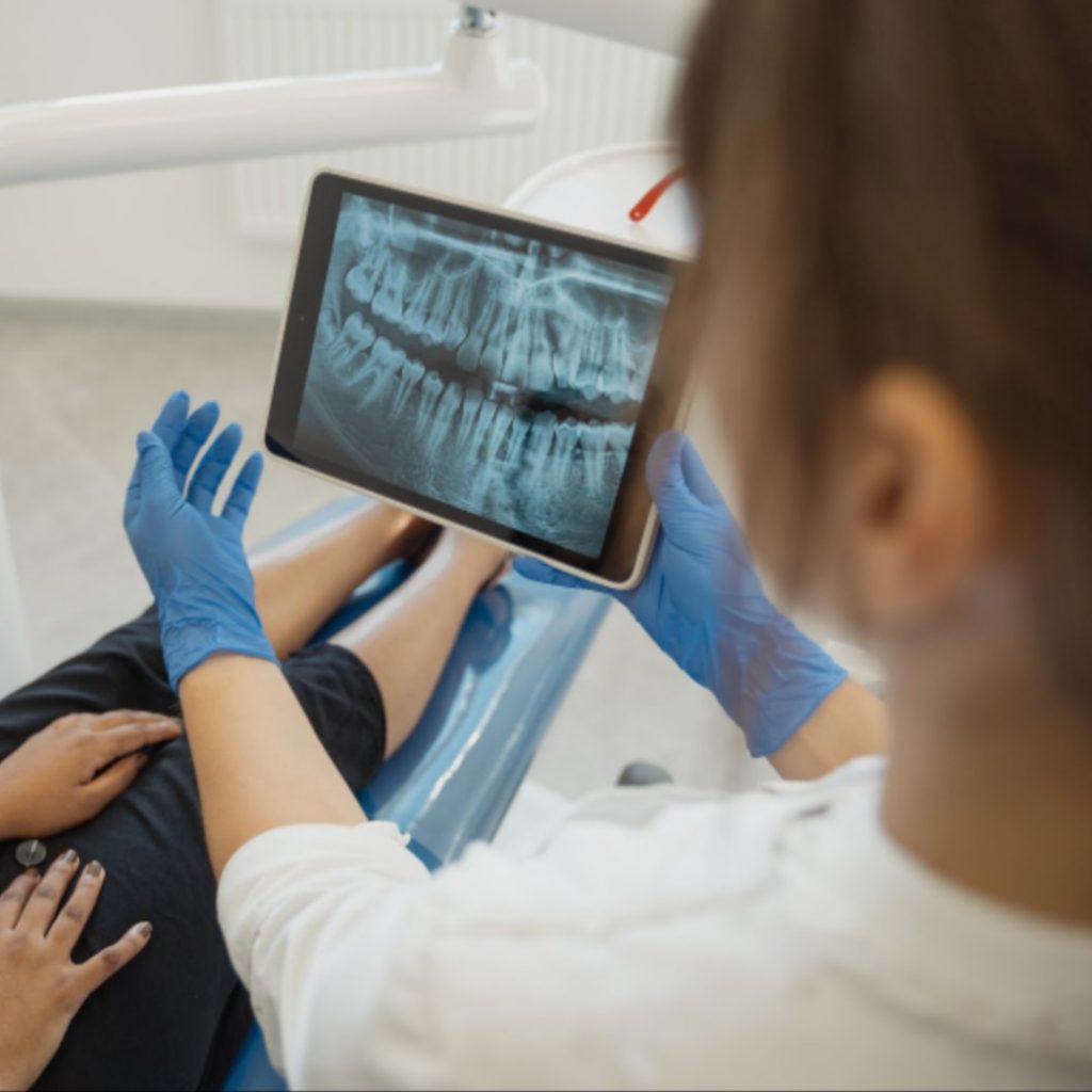 Wisdom Tooth Extraction | Loveland, OH Extraction Dentist